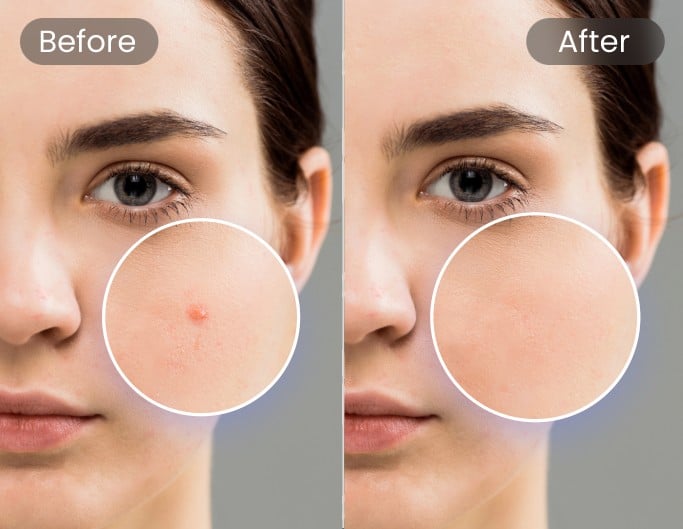 Clone Stamp Tool Online for Free | Fotor